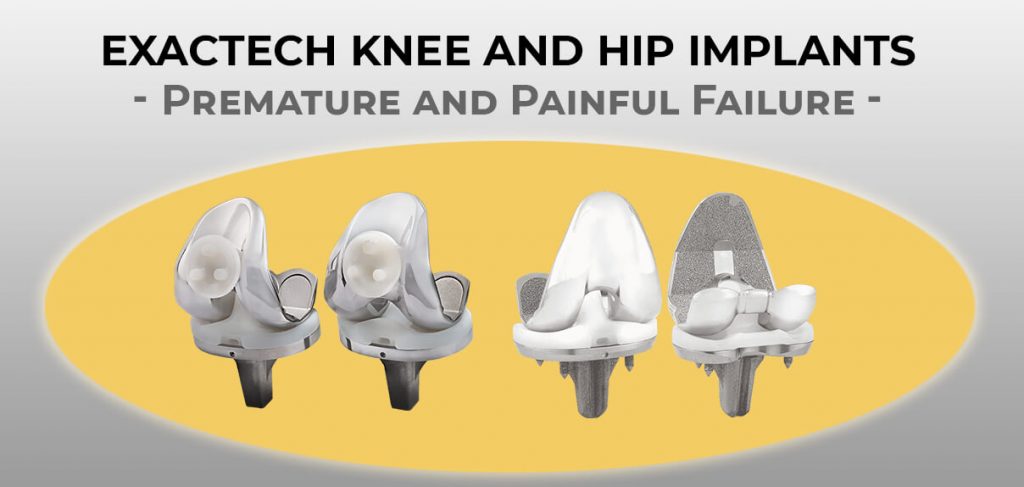 Exactech Knee and Hip Implant Investigation - Preuss | Foster Law